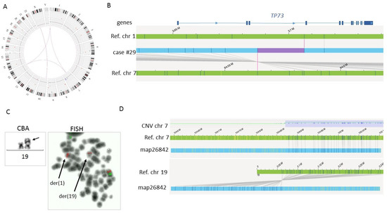 Optical Genome Mapping in Routine Cytogenetic Diagnosis of Acute Leukemia