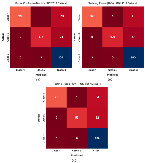 Henry Gas Solubility Optimization Algorithm based Feature Extraction in Dermoscopic Images ...