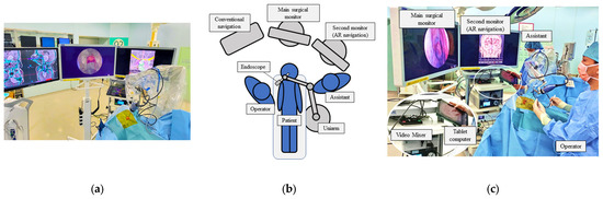 Efficacy of a Novel Augmented Reality Navigation System Using 3D ...