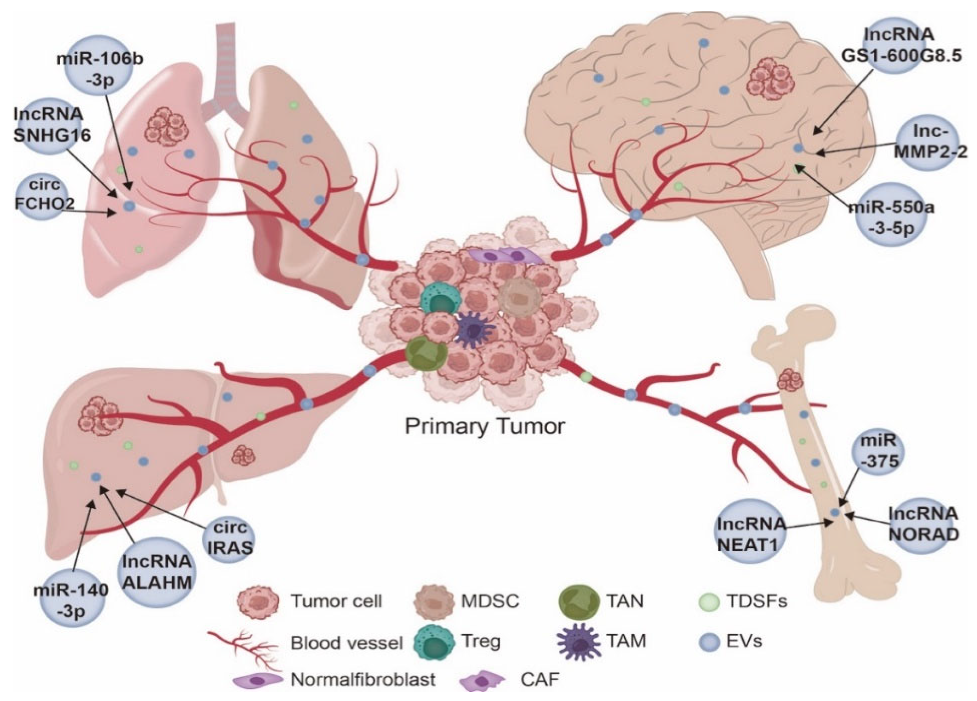 Non-Coding RNAs Derived from Extracellular Vesicles Promote Pre-Metastatic Niche Formation and ...