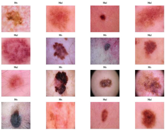 DSCC_Net: Multi-Classification Deep Learning Models for Diagnosing of Skin Cancer Using ...