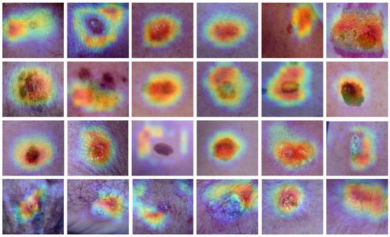 DSCC_Net: Multi-Classification Deep Learning Models for Diagnosing of Skin Cancer Using ...