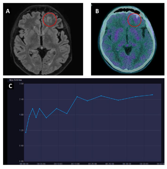 Cancers | Free Full-Text | The Role of Molecular Imaging in Patients ...