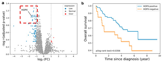 CT Image-Based Biopsy to Aid Prediction of HOPX Expression Status and ...