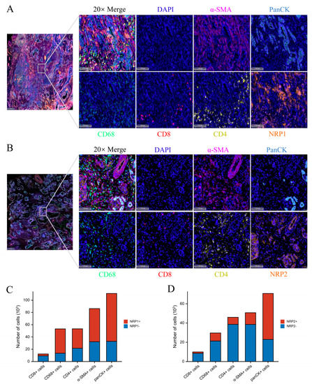 Immune Checkpoint Neuropilins as Novel Biomarkers and Therapeutic ...