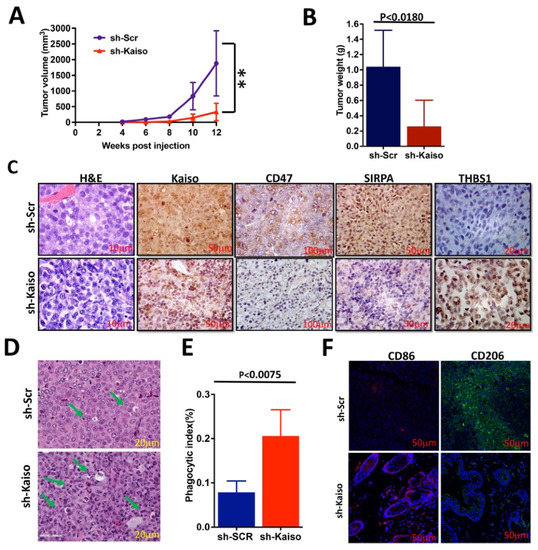 Immune Profile of Exosomes in African American Breast Cancer Patients ...