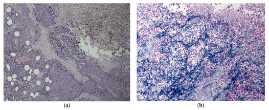 E. coli Phagelysate: A Primer to Enhance Nanoparticles and Drug ...