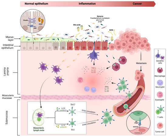 Cancers Free Full Text Inflammation Driven Colorectal Cancer Associated With Colitis From