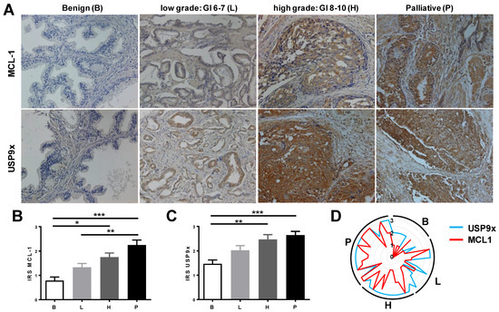 Protein Levels of Anti-Apoptotic Mcl-1 and the Deubiquitinase USP9x Are ...