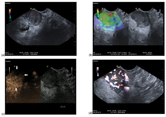 Comments on and Illustrations of the EFSUMB CEUS Guidelines ...