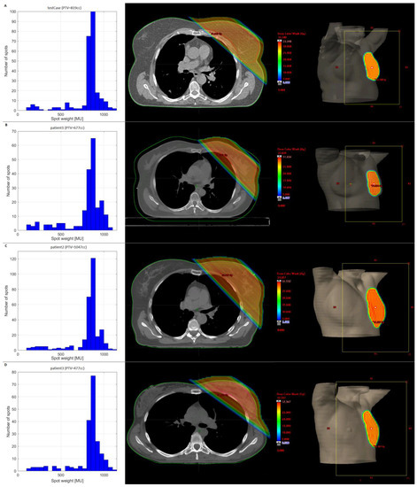 Single Ultra-High Dose Rate Proton Transmission Beam for Whole Breast ...
