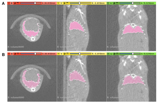 Assessment of Variabilities in Lung-Contouring Methods on CBCT ...