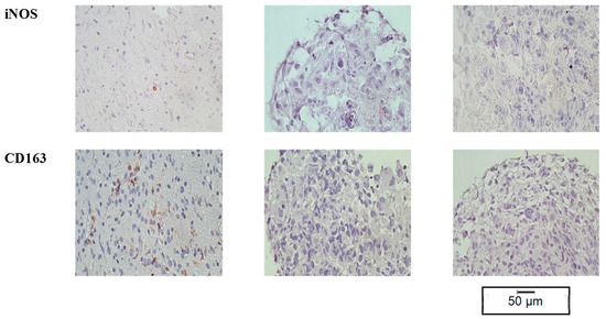 Characterization and Optimization of the Tumor Microenvironment in ...
