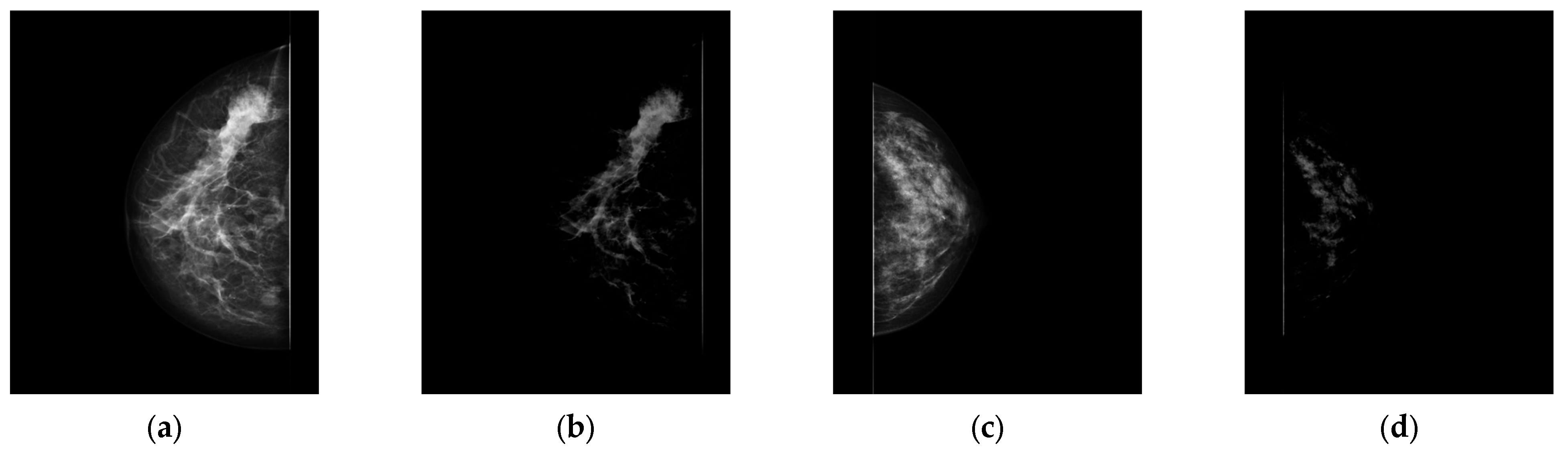 Cancers Free Full Text Attention Based Deep Learning System For
