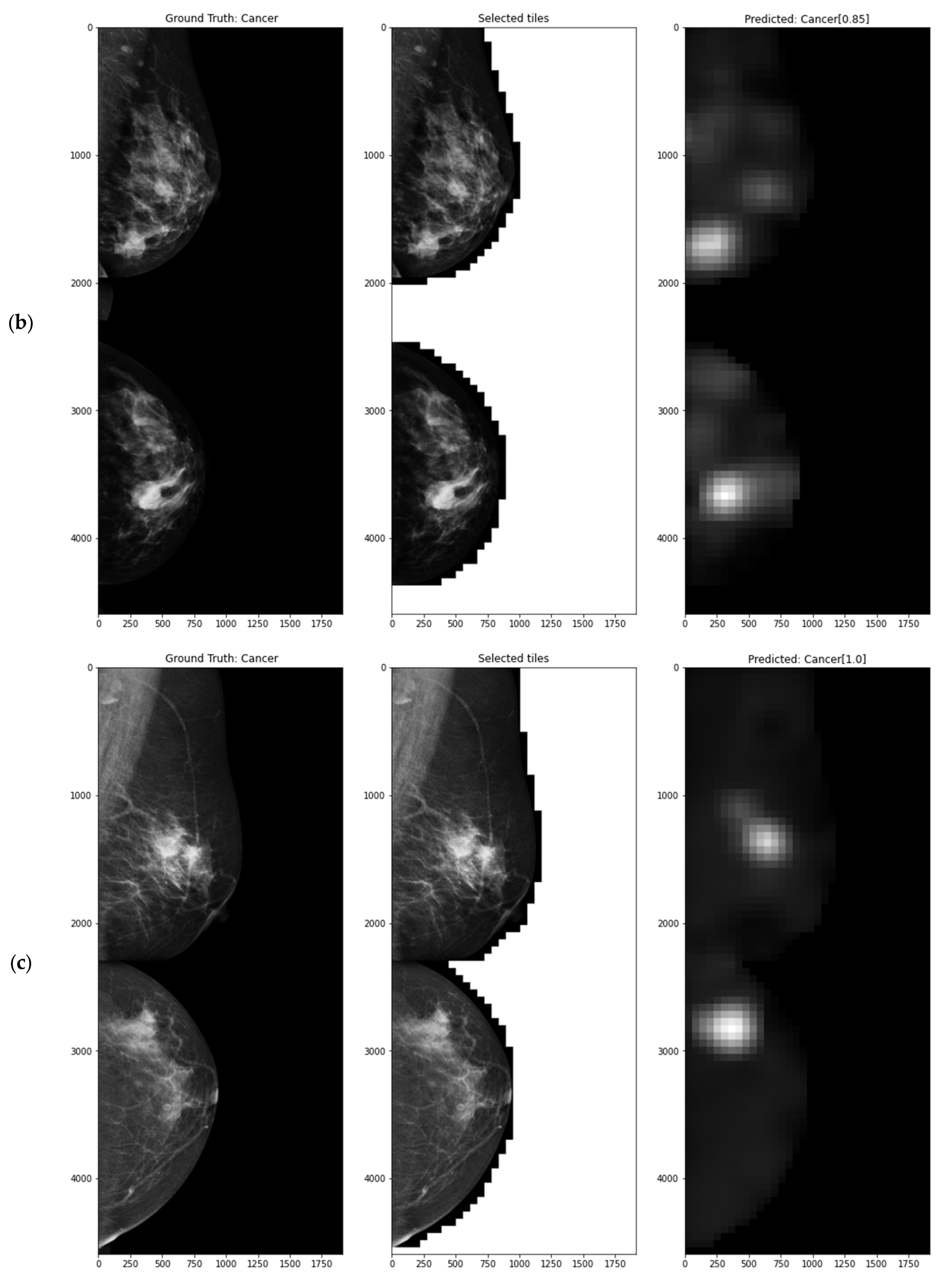 Cancers Free Full Text Attention Based Deep Learning System For
