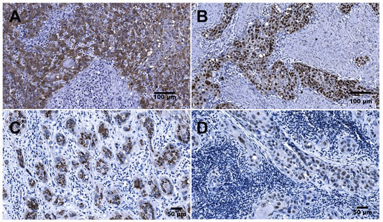 Cancers Free Full Text The Role Of The P16 And P53 Tumor Suppressor
