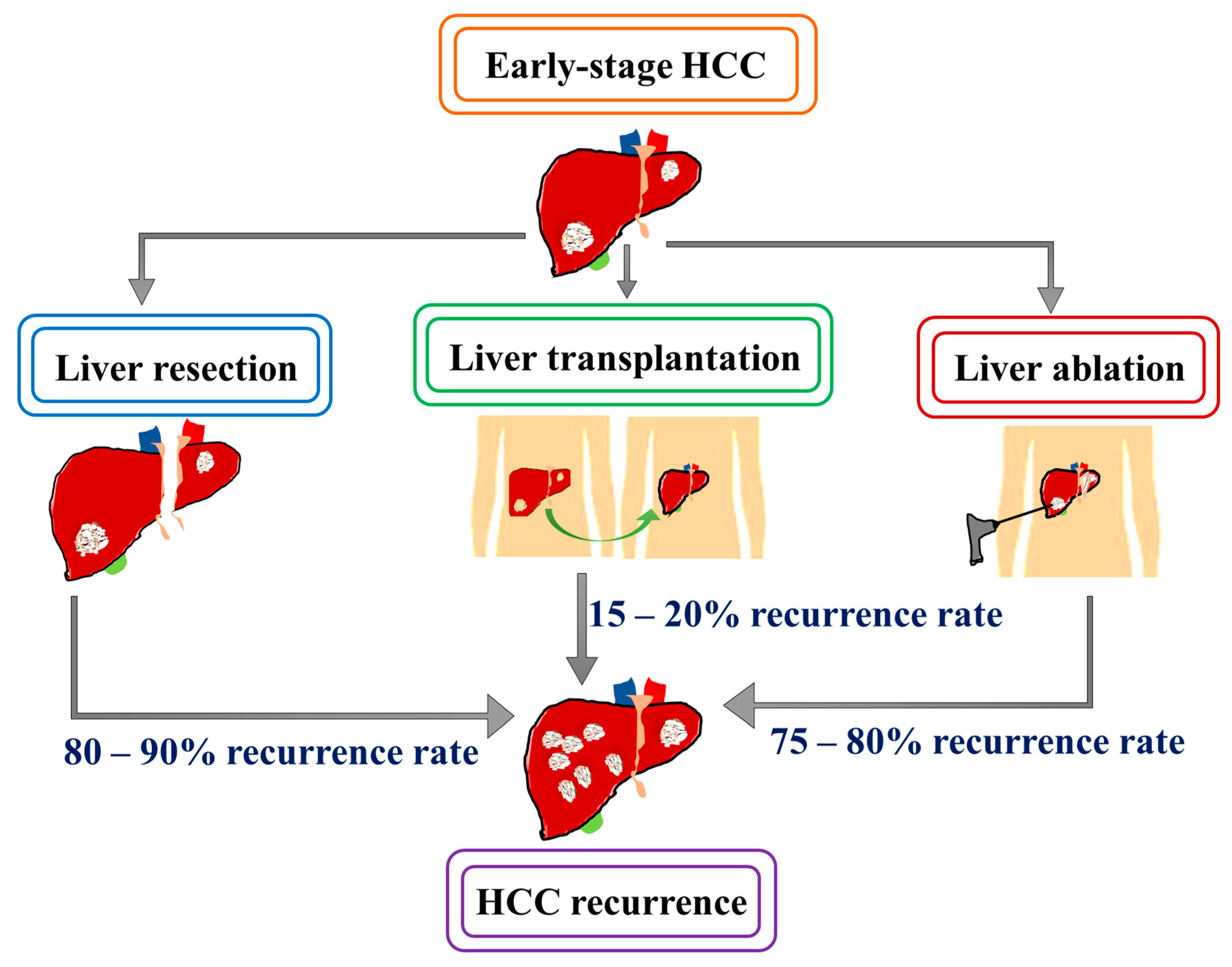 Decoding Immune Signature to Detect the Risk for Early-Stage HCC Recurrence Decoding Immune Signature to Detect the Risk for Early-Stage HCC Recurrence