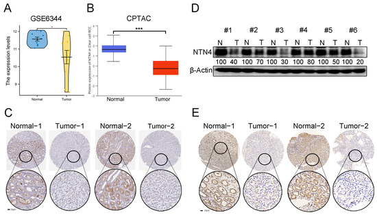 Netrin Family Genes as Prognostic Markers and Therapeutic Targets for ...