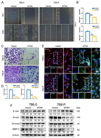 Netrin Family Genes as Prognostic Markers and Therapeutic Targets for ...