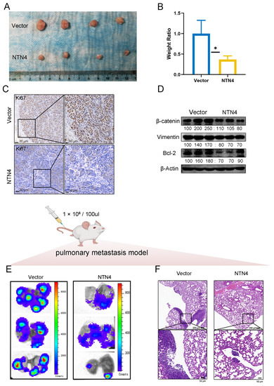 Netrin Family Genes as Prognostic Markers and Therapeutic Targets for ...