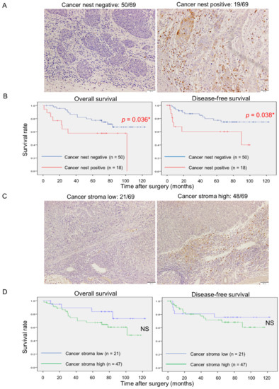Matrix Metalloproteinase 9 Induced in Esophageal Squamous Cell ...