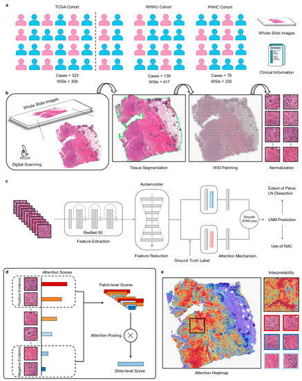 Predicting Lymph Node Metastasis Status from Primary Muscle-Invasive ...