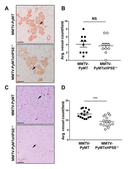 Investigating the Role of Heparanase in Breast Cancer Development ...