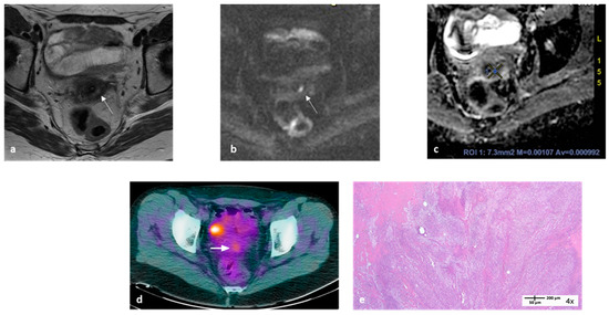 The Role of Multimodal Imaging in Pathological Response Prediction of ...