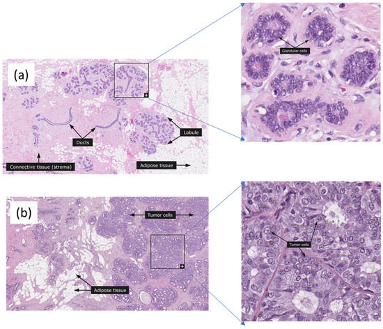 Deep Learning- and Expert Knowledge-Based Feature Extraction and ...