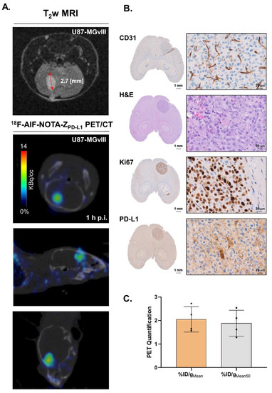Immuno-PET Imaging of Tumour PD-L1 Expression in Glioblastoma