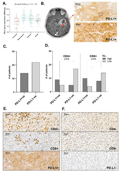Immuno-PET Imaging of Tumour PD-L1 Expression in Glioblastoma
