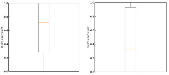 Deep Learning Algorithm for Differentiating Patients with a Healthy ...
