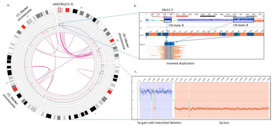 Clinical Utility of Optical Genome Mapping and 523-Gene Next Generation Sequencing Panel for ...