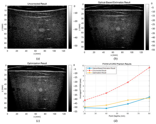 Ultrasound Imaging with Flexible Array Transducer for Pancreatic Cancer ...