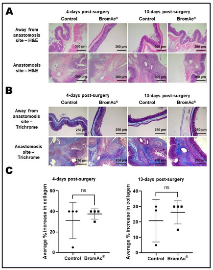Cancers | Free Full-Text | Intraperitoneal BromAc® Does Not Interfere ...