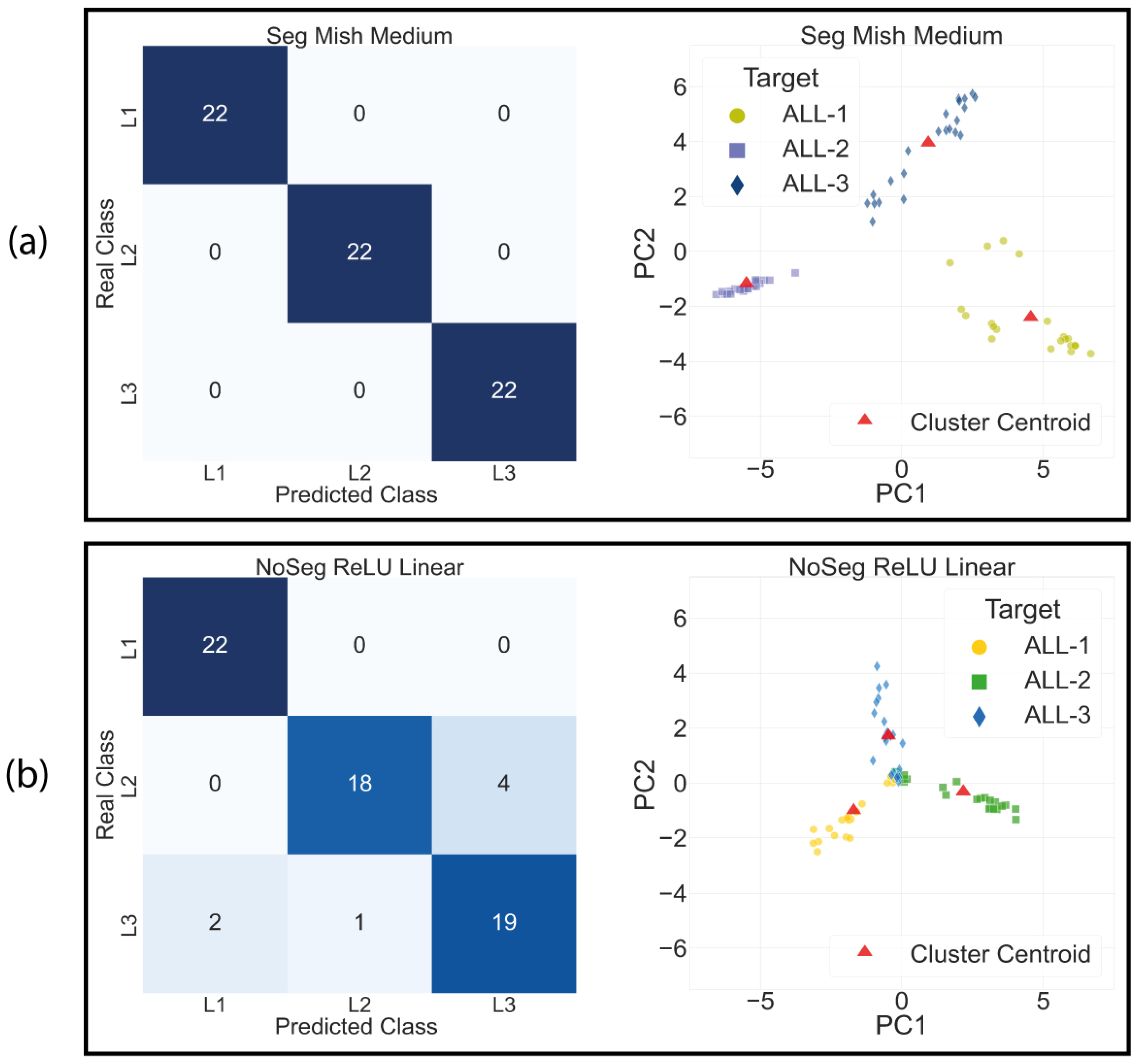 Explainable CAD System for Classification of Acute Lymphoblastic Leukemia Based on a Robust ...