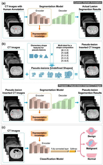 Annotation-Efficient Deep Learning Model for Pancreatic Cancer ...