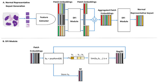 NRK-ABMIL: Subtle Metastatic Deposits Detection for Predicting Lymph Node Metastasis in Breast ...