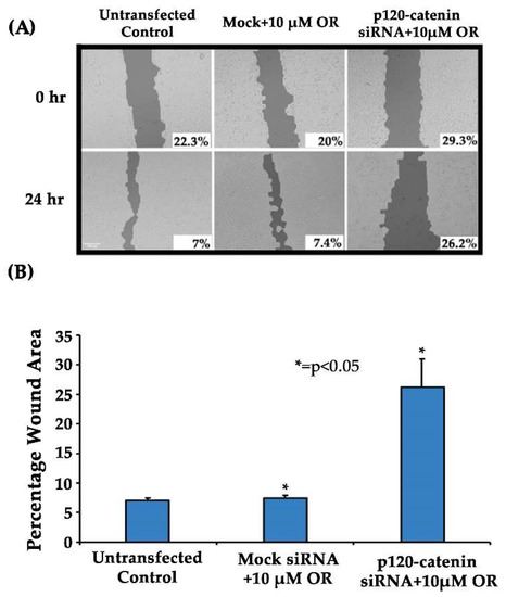PRMT-1 and p120-Catenin as EMT Mediators in Osimertinib Resistance in NSCLC