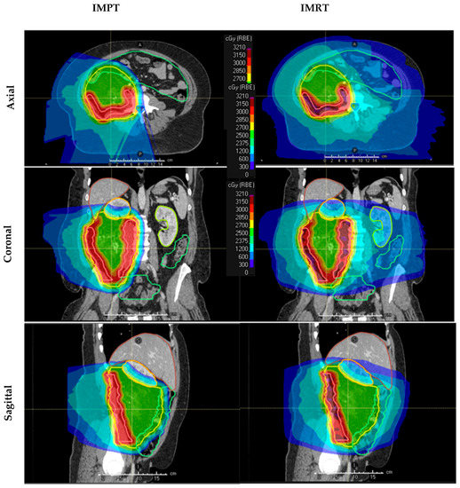 Cancers | Free Full-Text | Comparative In Silico Analysis of Ultra ...