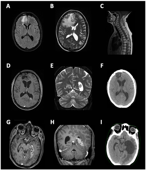 The Effectiveness of Cancer Immune Checkpoint Inhibitor Retreatment and ...