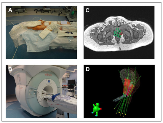 Increasing Patient Safety and Treatment Quality by Using Intraoperative ...