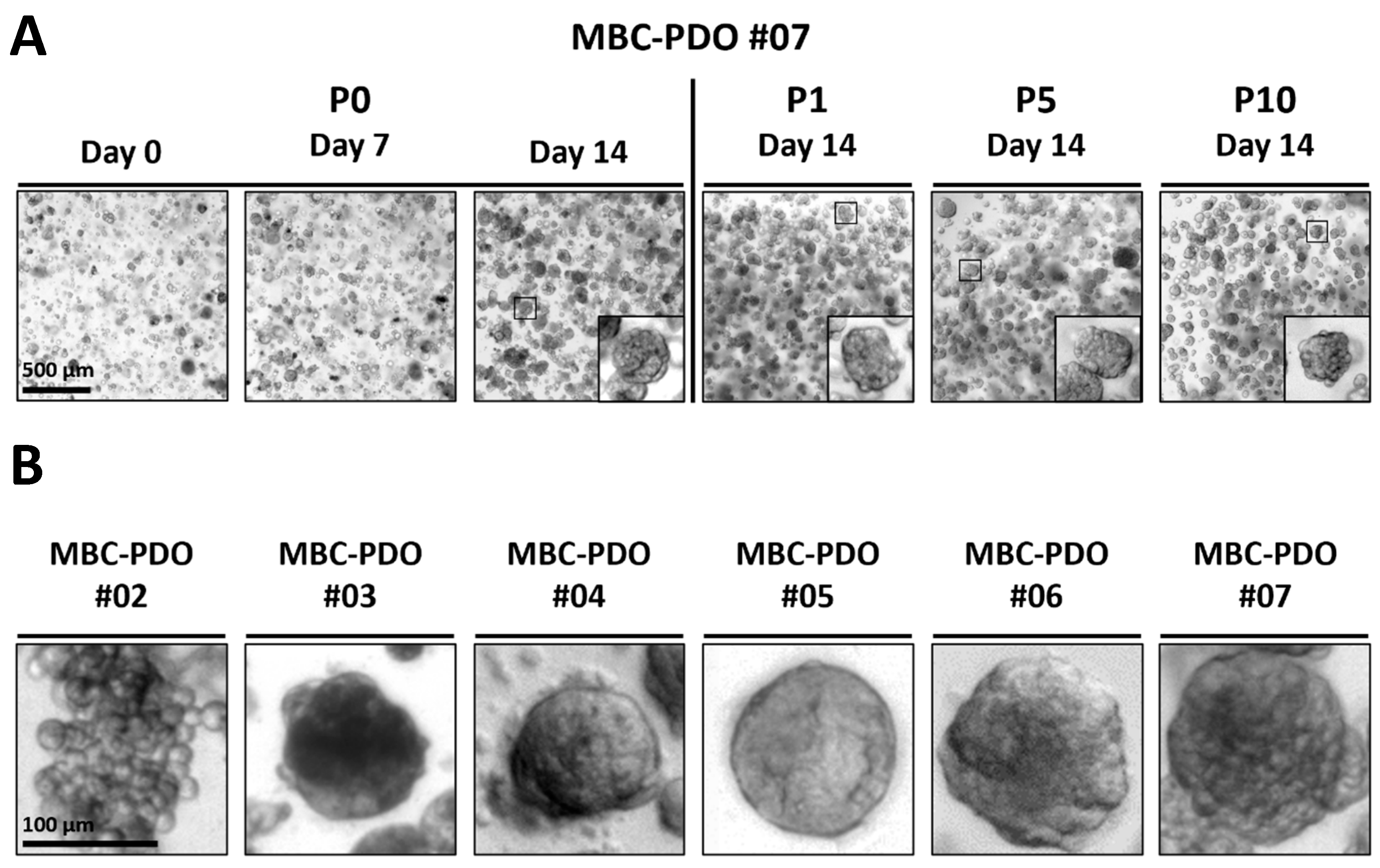 Advancing Cancer Therapy Predictions with Patient-Derived Organoid ...