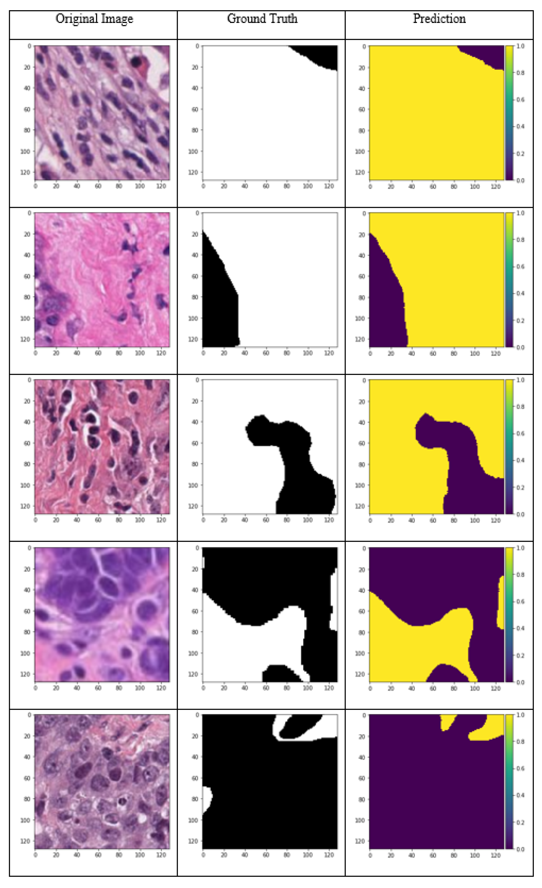 Automated Detection and Scoring of Tumor-Infiltrating Lymphocytes in ...