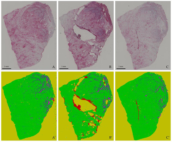Vessel Delineation Using U-Net: A Sparse Labeled Deep Learning Approach for Semantic ...