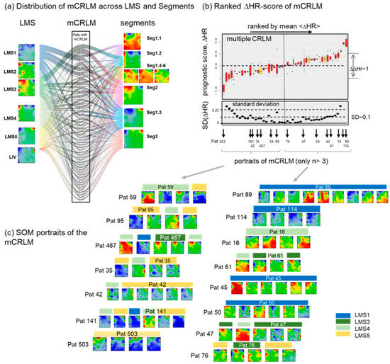 Transcriptomic Maps of Colorectal Liver Metastasis: Machine Learning of ...