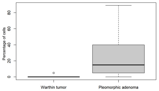 Novel Discovery of the Somatostatin Receptor (SSTR2) in Pleomorphic ...