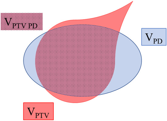 Stereotactic Radiation Therapy of Single Brain Metastases: A Literature ...