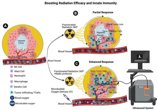 Innate Immune System in the Context of Radiation Therapy for Cancer