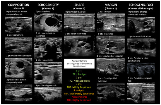 Performance of ACR TI-RADS and the Bethesda System in Predicting Risk ...